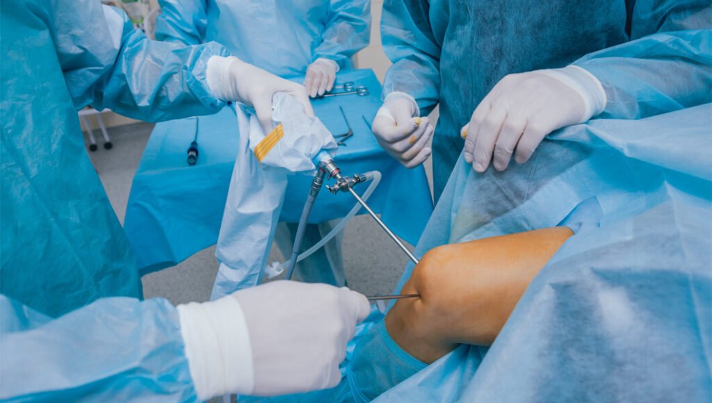 Knee Arthroscopy Surgeon in Ahmedabad | Knee Arthroscopy Surgery